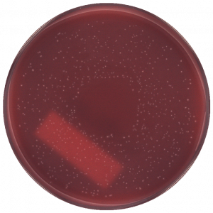 Rapid Plating with IUL’s Spiral Plating Method | Spiral Platers